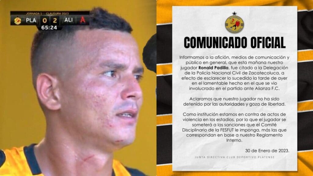 Platense aclara que Ronald Padilla no ha sido detenido